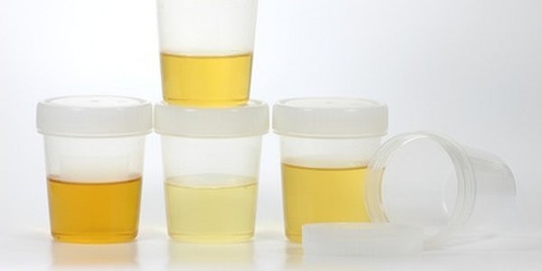 Urin - Alles zum Thema!