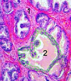 Prostata
