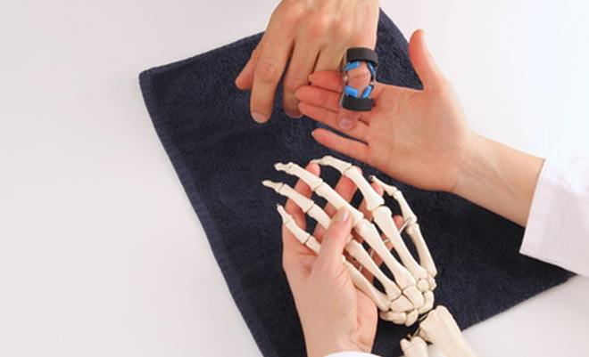 Fingergelenk Verrenkung