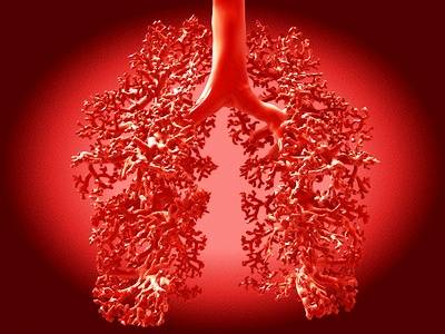 Symptome der Sarkoidose